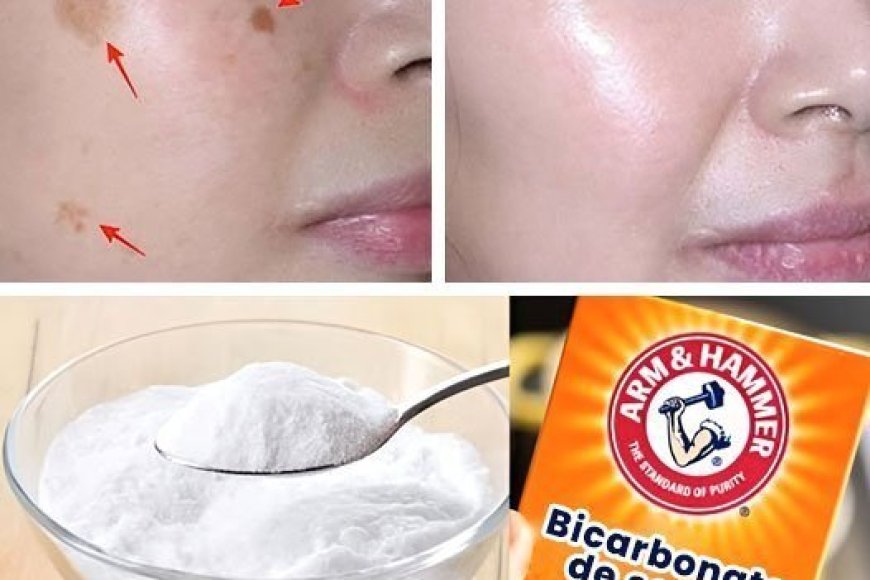 4 Ways to Erase Age Spots with Baking Soda for Younger, More Even Skin ...