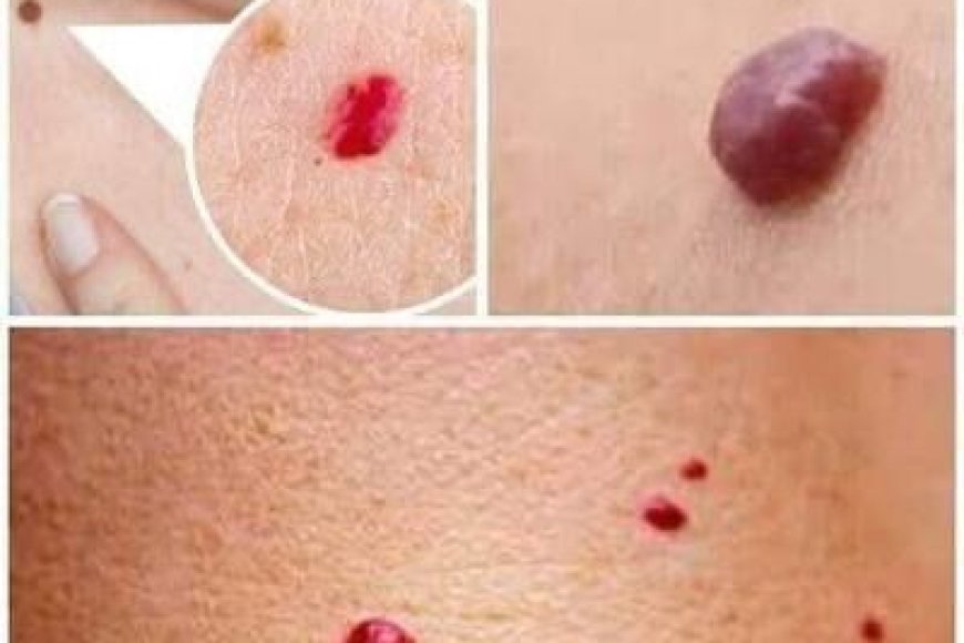 Small Red Dots on the Skin: What They Often Mean and When to Pay ...